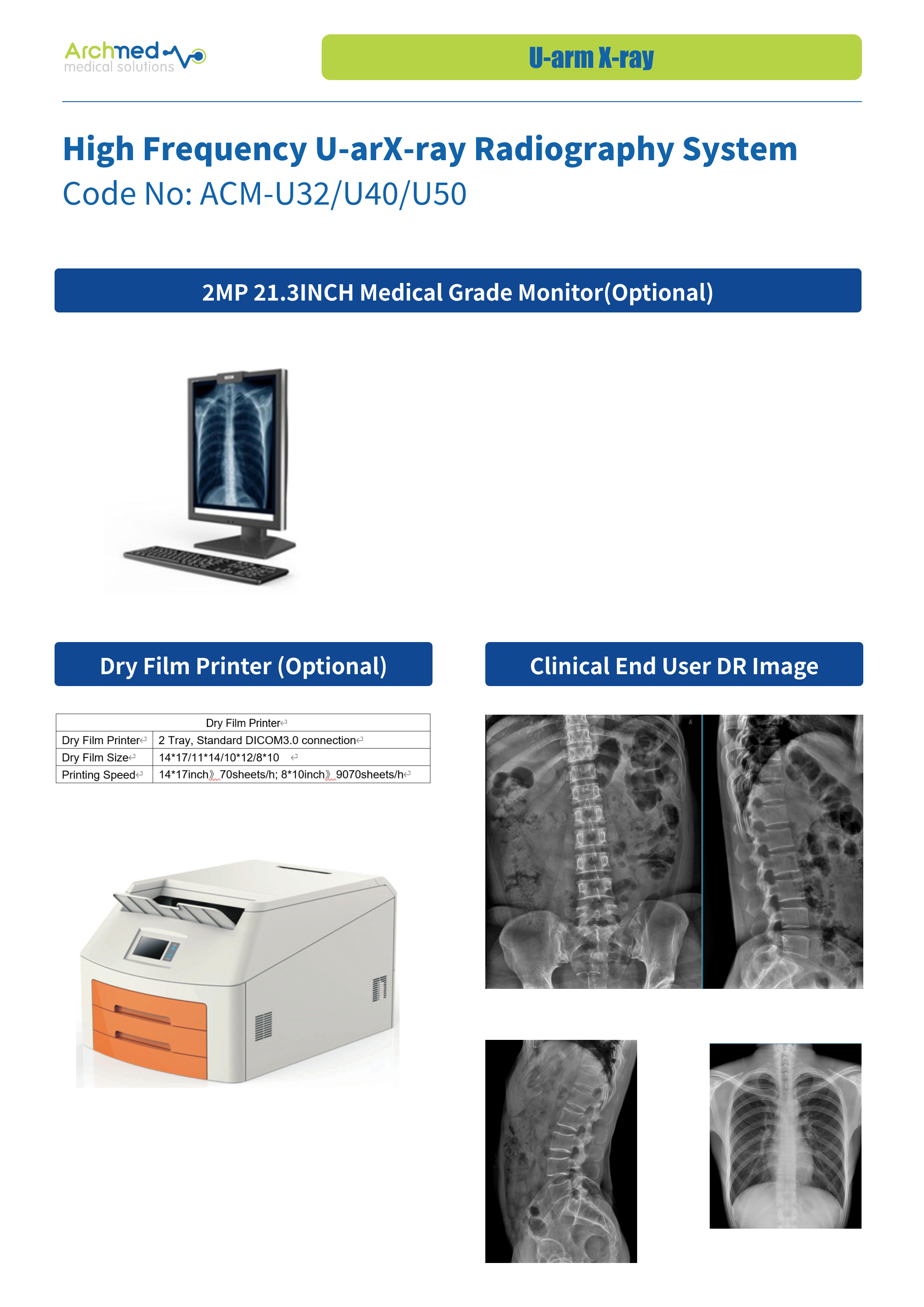 High Frequency U-arm X-ray Radiography System