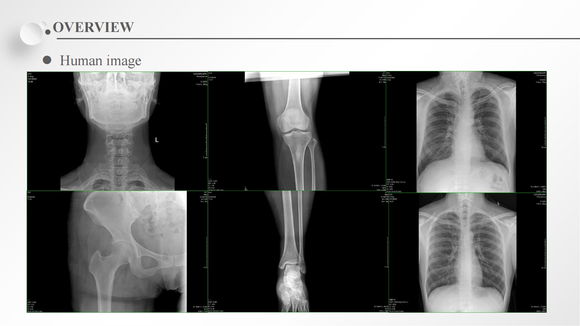560W Hand-held X-ray Machine - Archmedxray